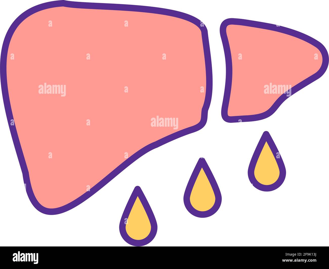 Fatty liver disease RGB color icon Stock Vector Image & Art - Alamy