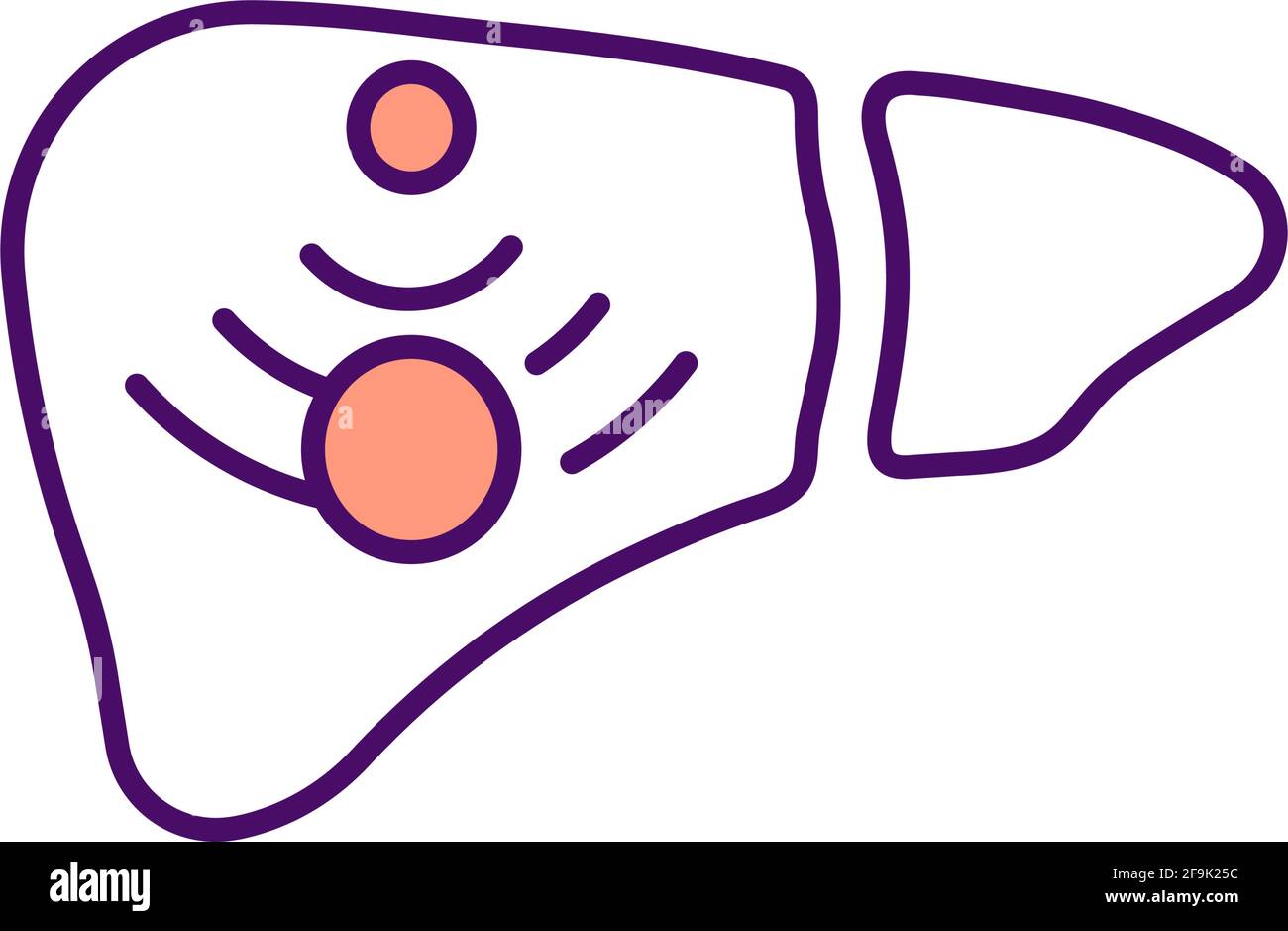 Cancer liver color line Stock Vector Images - Alamy