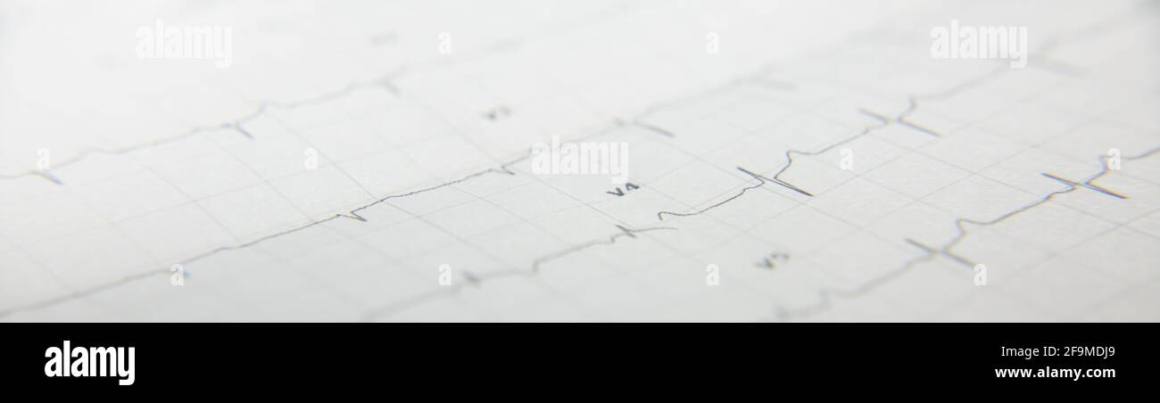 a card with a cardiogram of the heart Stock Photo - Alamy