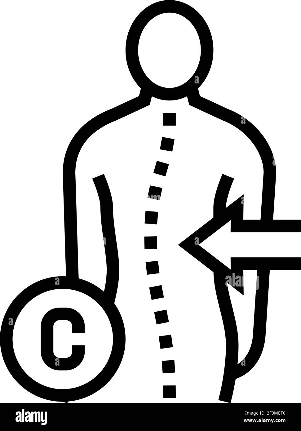 C shaped scoliosis hi-res stock photography and images - Alamy