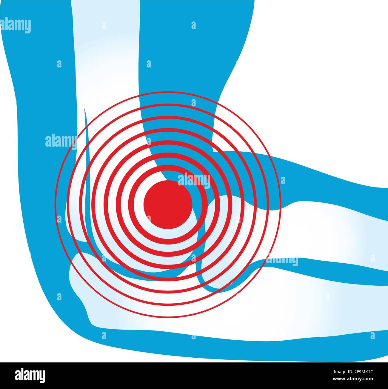 elbow rheumatological pain graphic icon Stock Vector Image & Art - Alamy