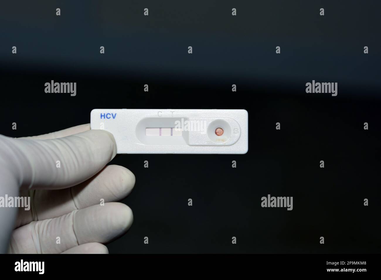 A positive result for Hepatitis C rapid test kit cassette that checks ...