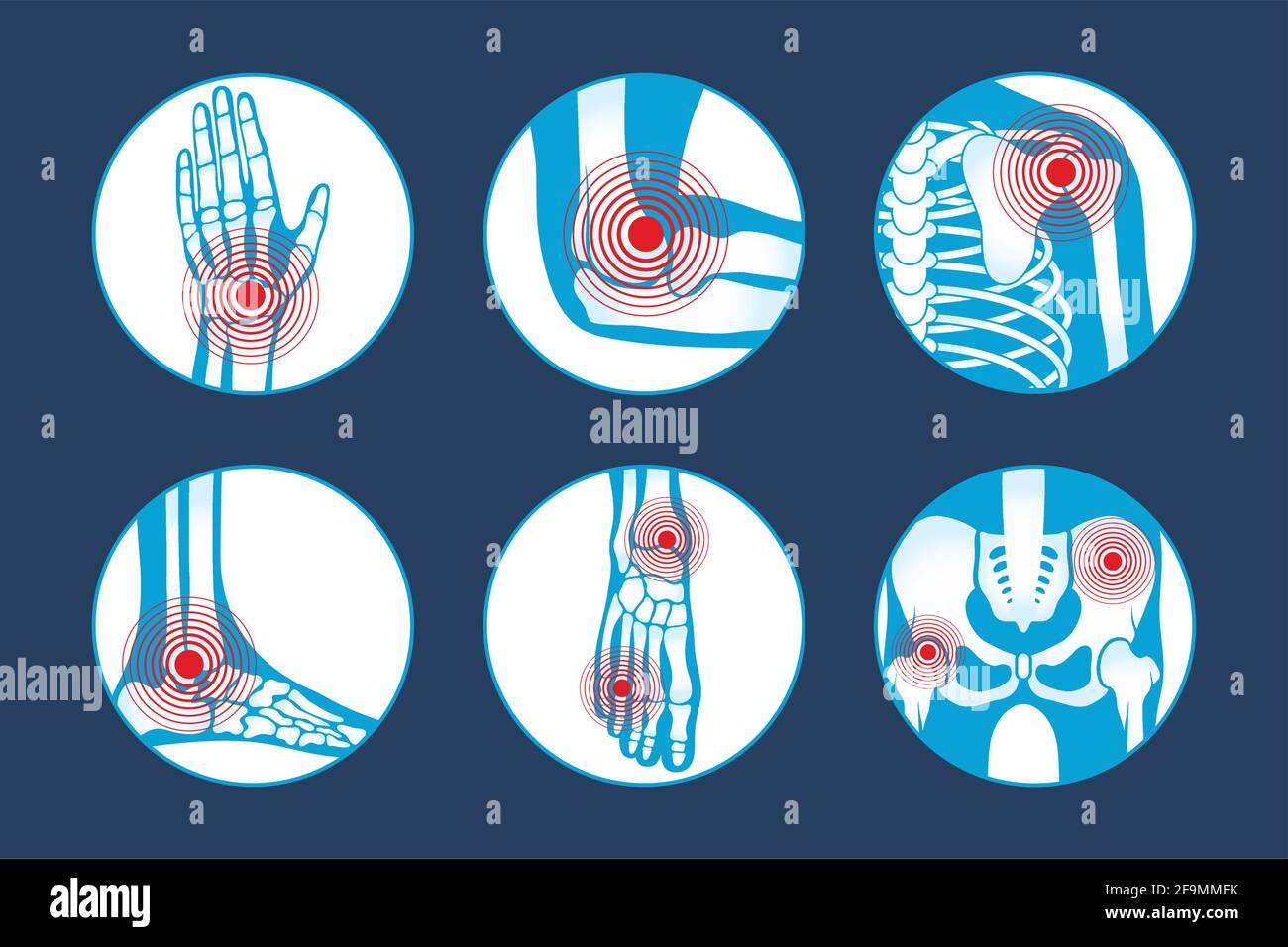 six rheumatology disease set icons Stock Vector Image & Art - Alamy