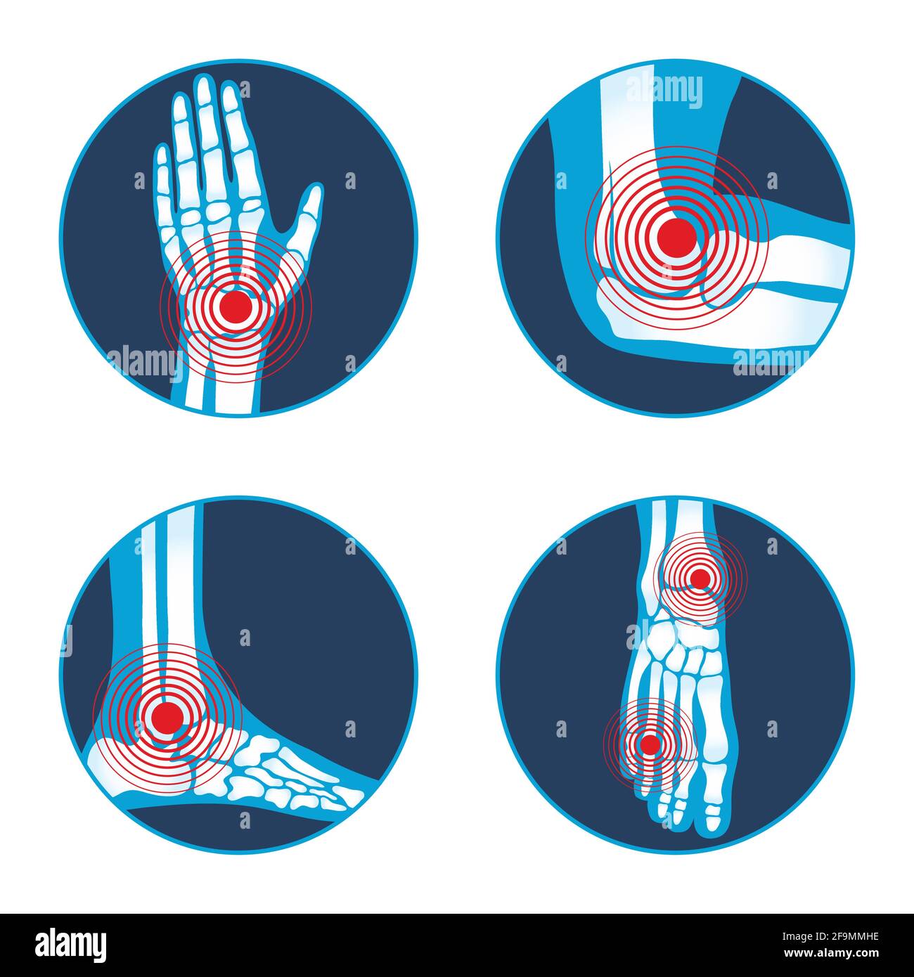four rheumatology disease set icons Stock Vector Image & Art - Alamy