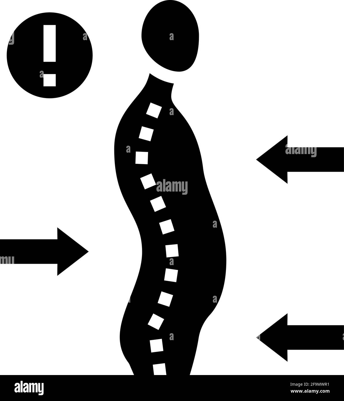 Scoliosis Disease Glyph Icon Vector Illustration Stock Vector Image