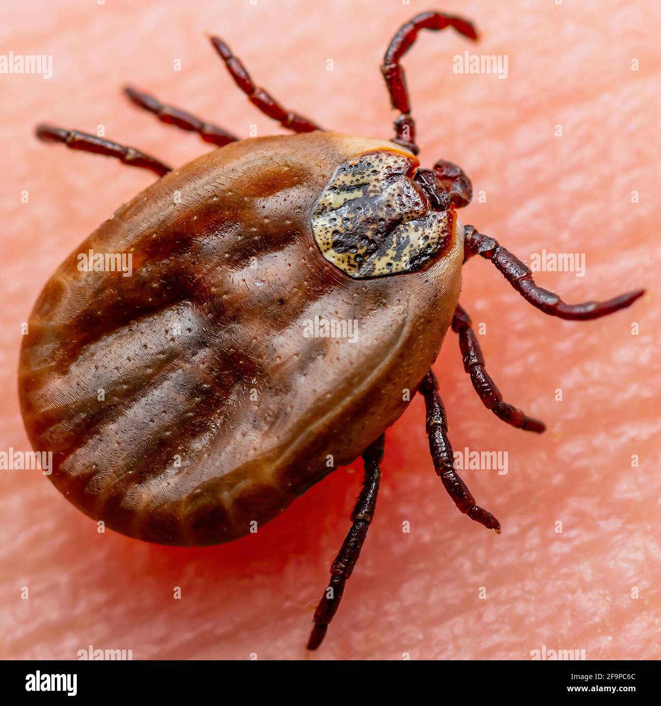 Encephalitis Virus or Lyme Borreliosis Disease Infectious Dermacentor ...