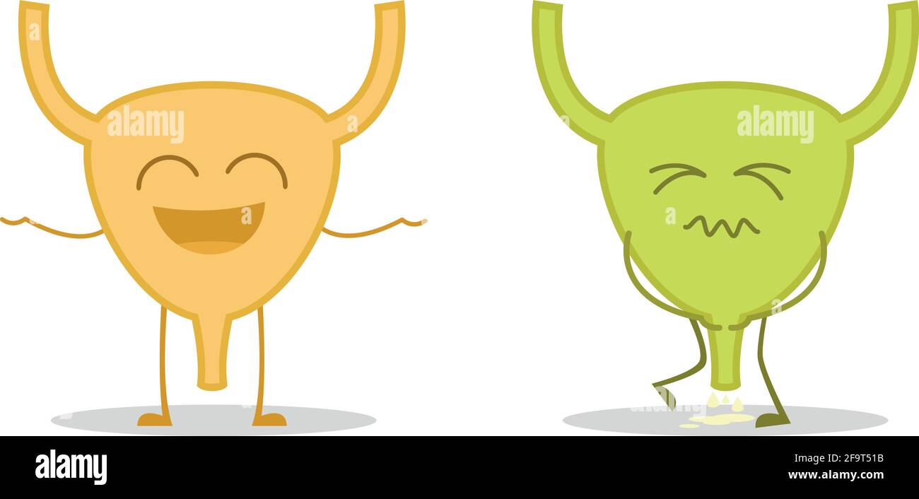 Healthy and sick bladder isolated on white background vector ...