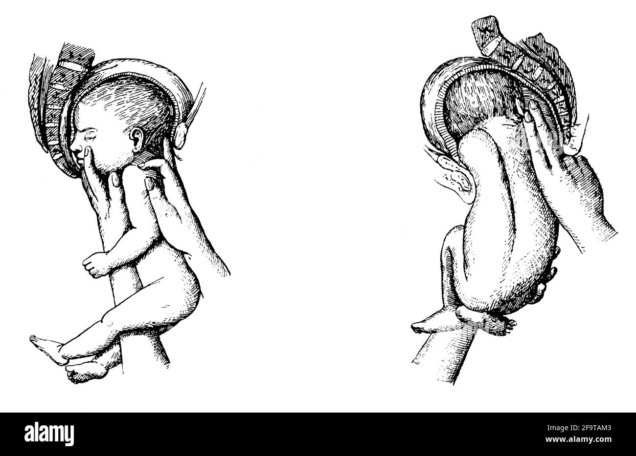 Obstetrics vintage hi-res stock photography and images - Alamy