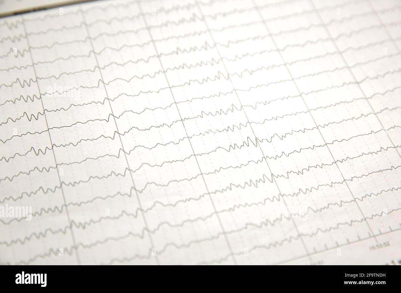 a card with a cardiogram of the heart Stock Photo - Alamy