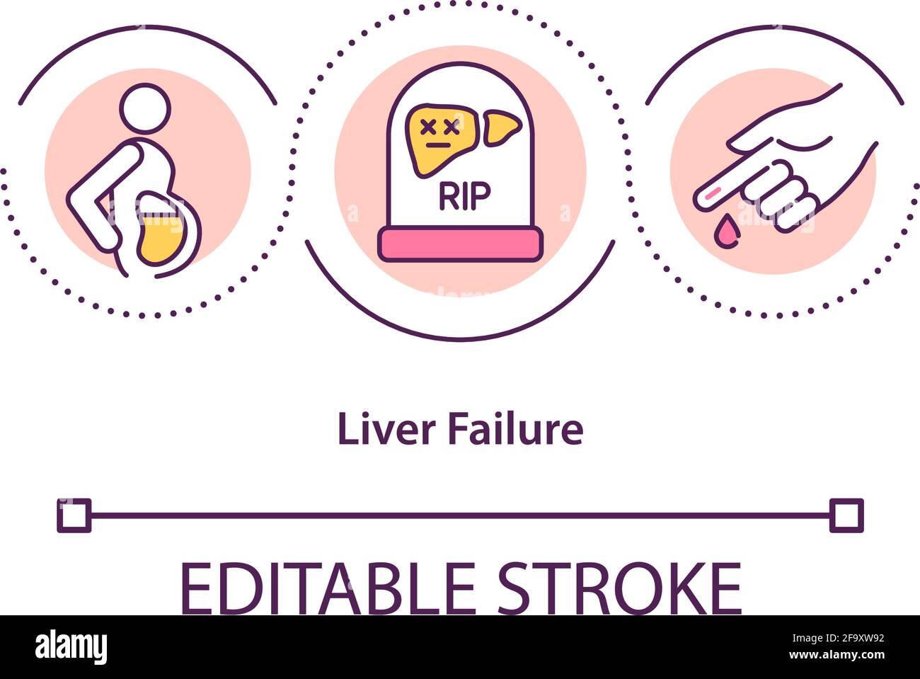 Acute liver failure hi-res stock photography and images - Alamy