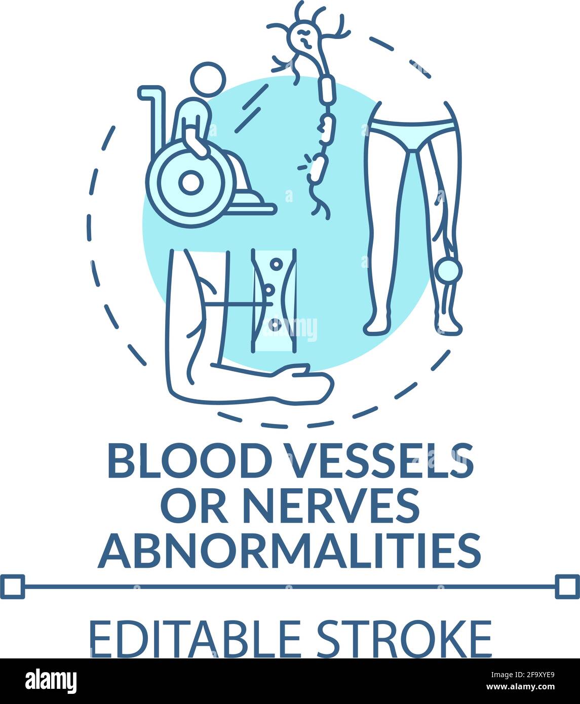 Blood vessels and nerves abnormalities concept icon Stock Vector Image ...
