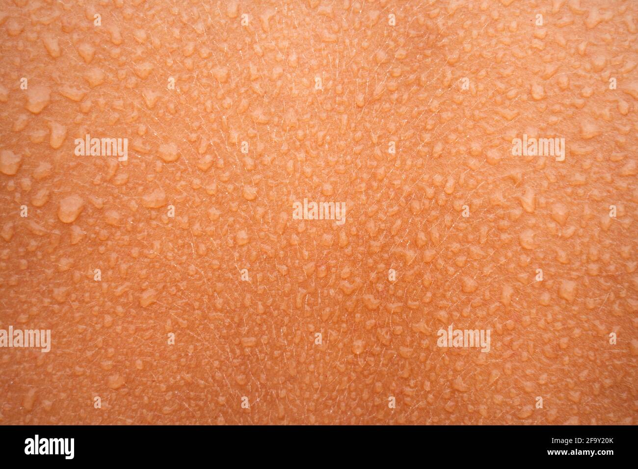 Water or sweat drops on human skin. Wet skin Stock Photo - Alamy