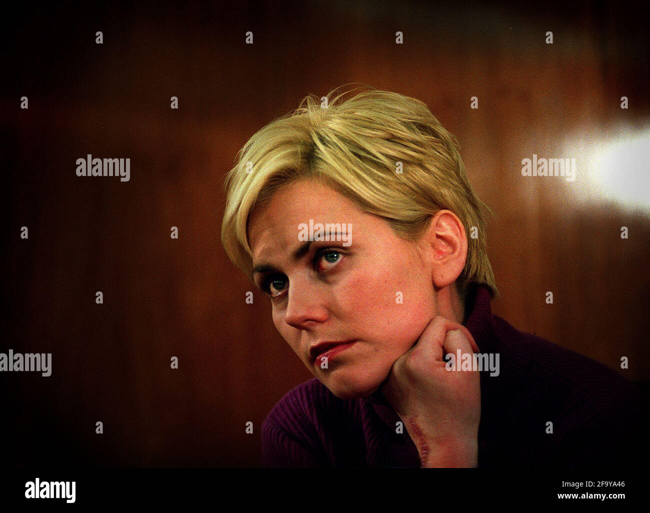 LISA POTTS BEARING THE SCARS OF HER ORDEAL AT A PRESS CONFERENCE AT ...