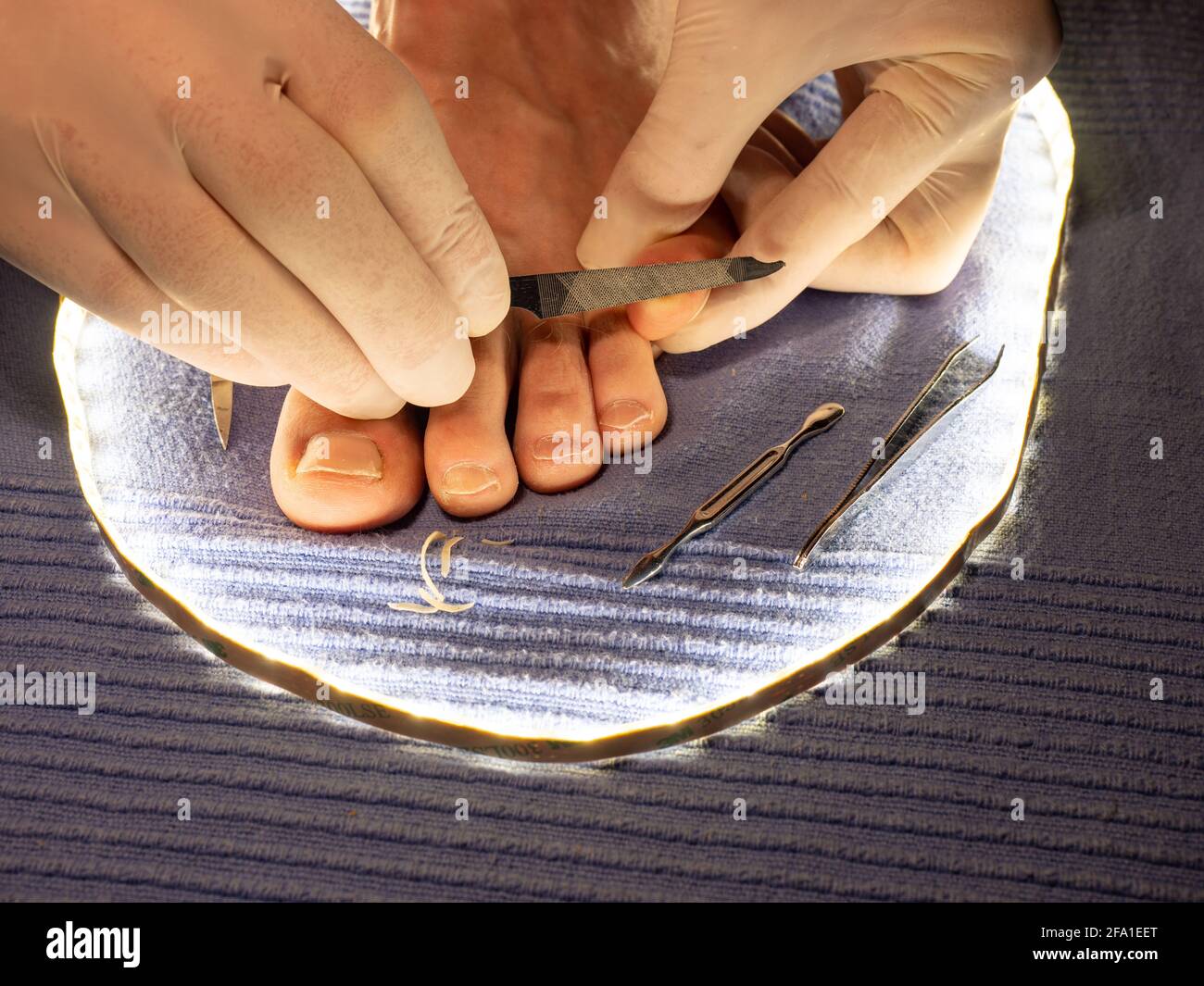 Hands in white sterile gloves file toenails with long pointed file on ...