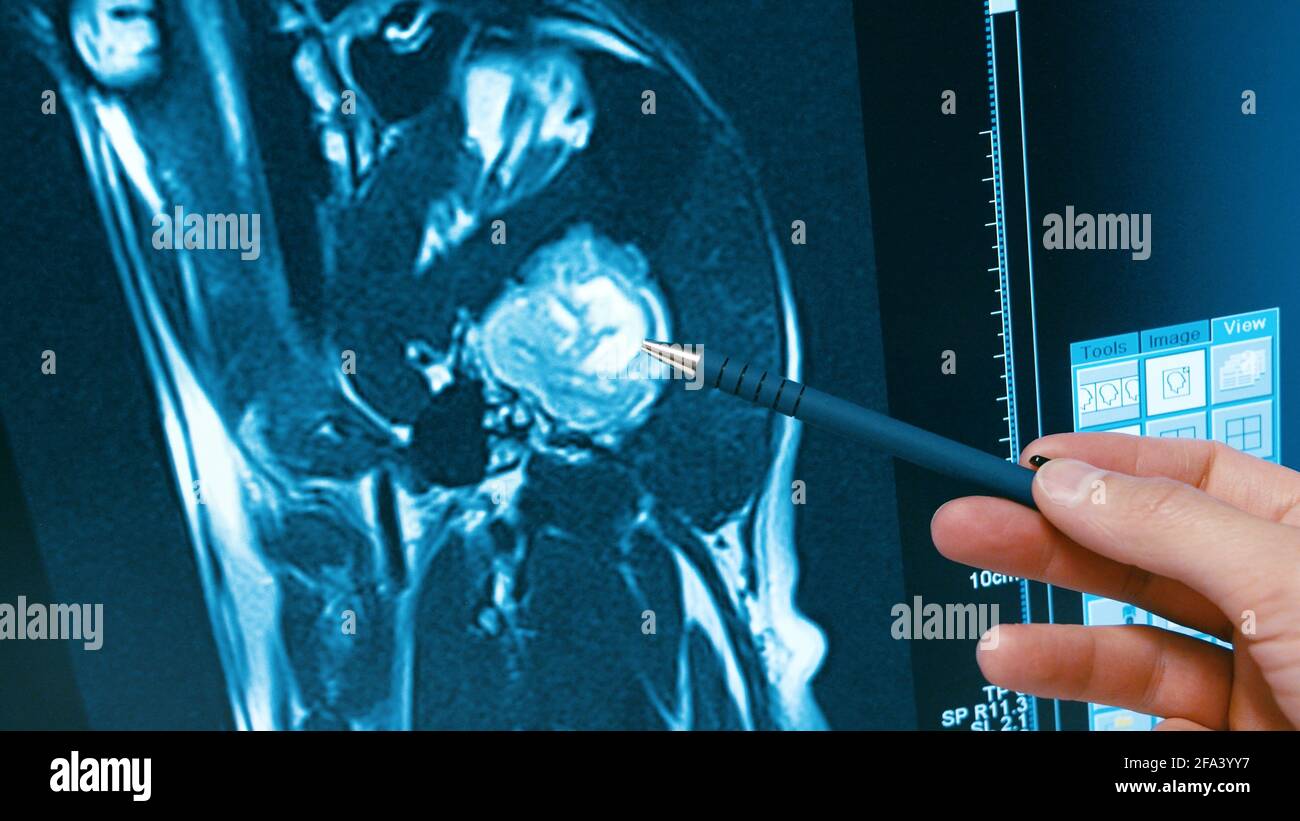 Animal brain mri hi-res stock photography and images - Alamy