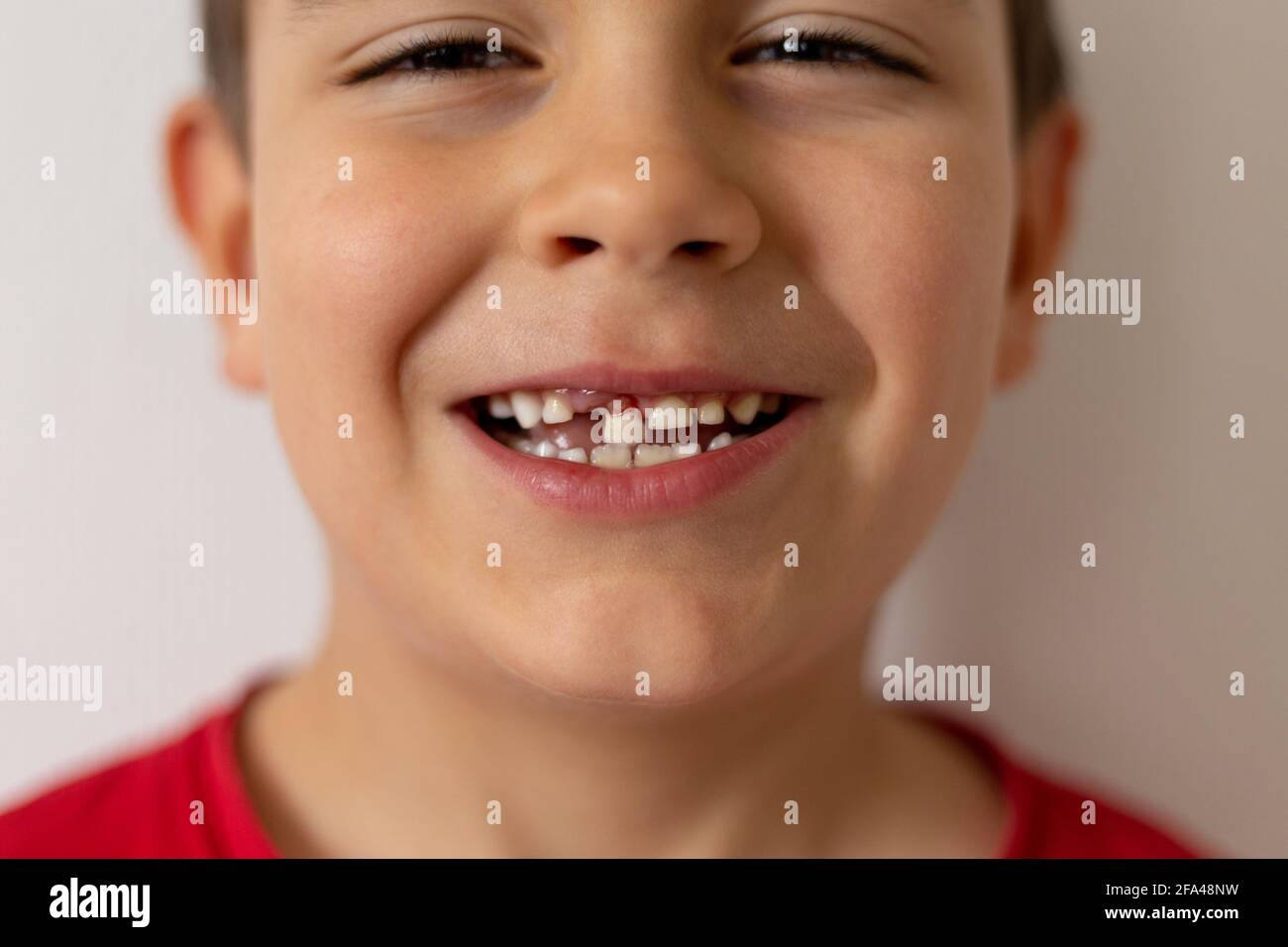 Wobbly tooth hi-res stock photography and images - Alamy