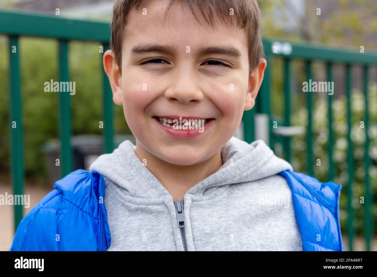 A close up of a small child smiling at the camera, First molar teeth ...