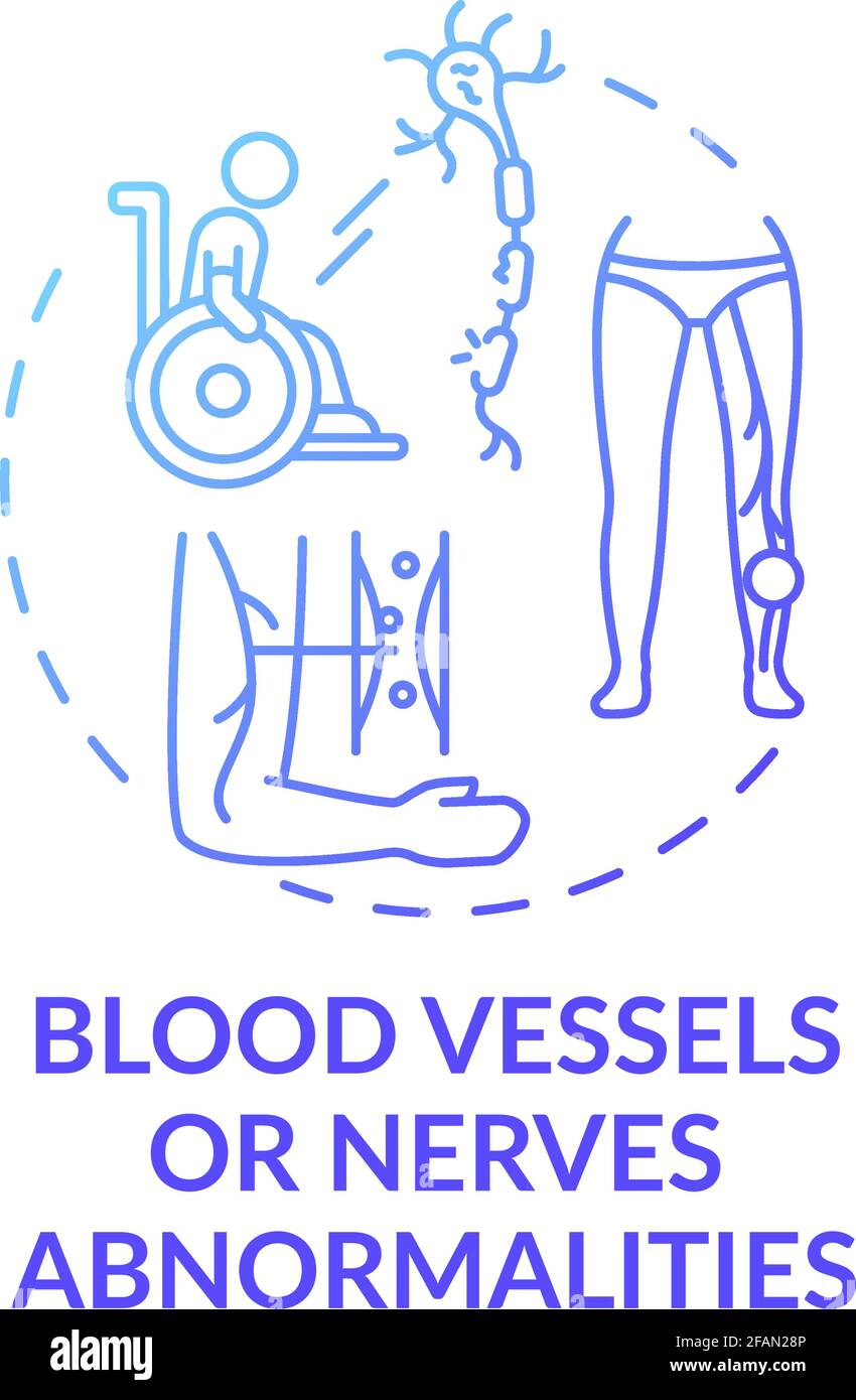 Abnormal blood vessels Stock Vector Images - Alamy