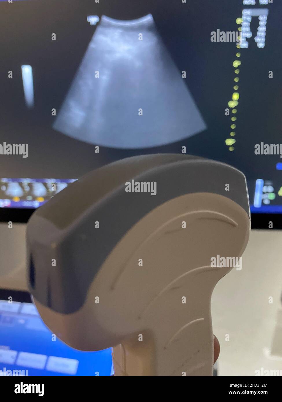 Ultrasound probe closeup with blurred display in background Stock Photo ...