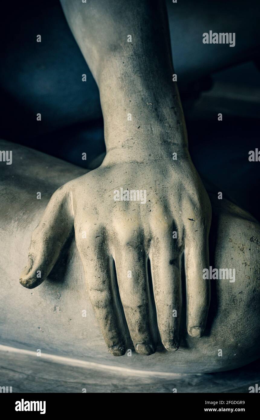 Vintage leg cast hi-res stock photography and images - Alamy