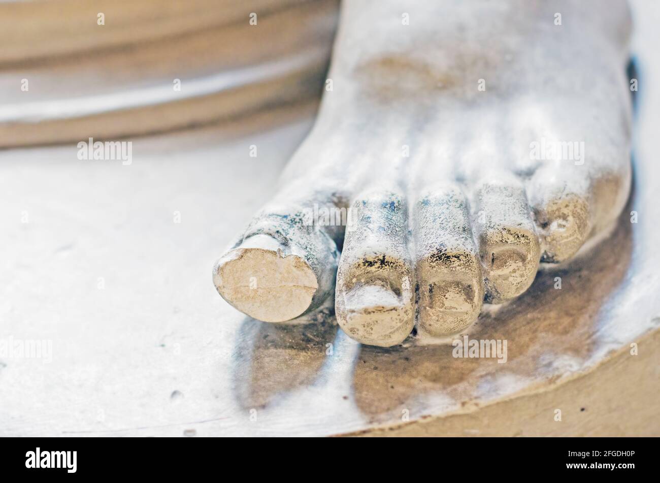 Vintage leg cast hi-res stock photography and images - Alamy