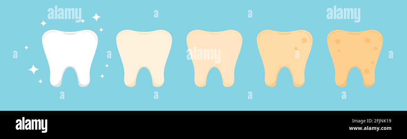 Dental Plaque Formation Animation
