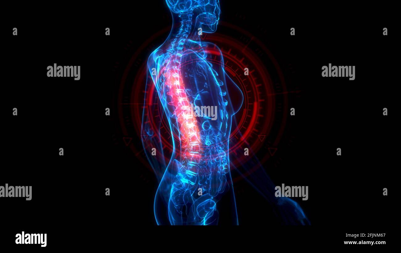 Thoracic, middle part of backbone on x-ray body, medicine 3d ...