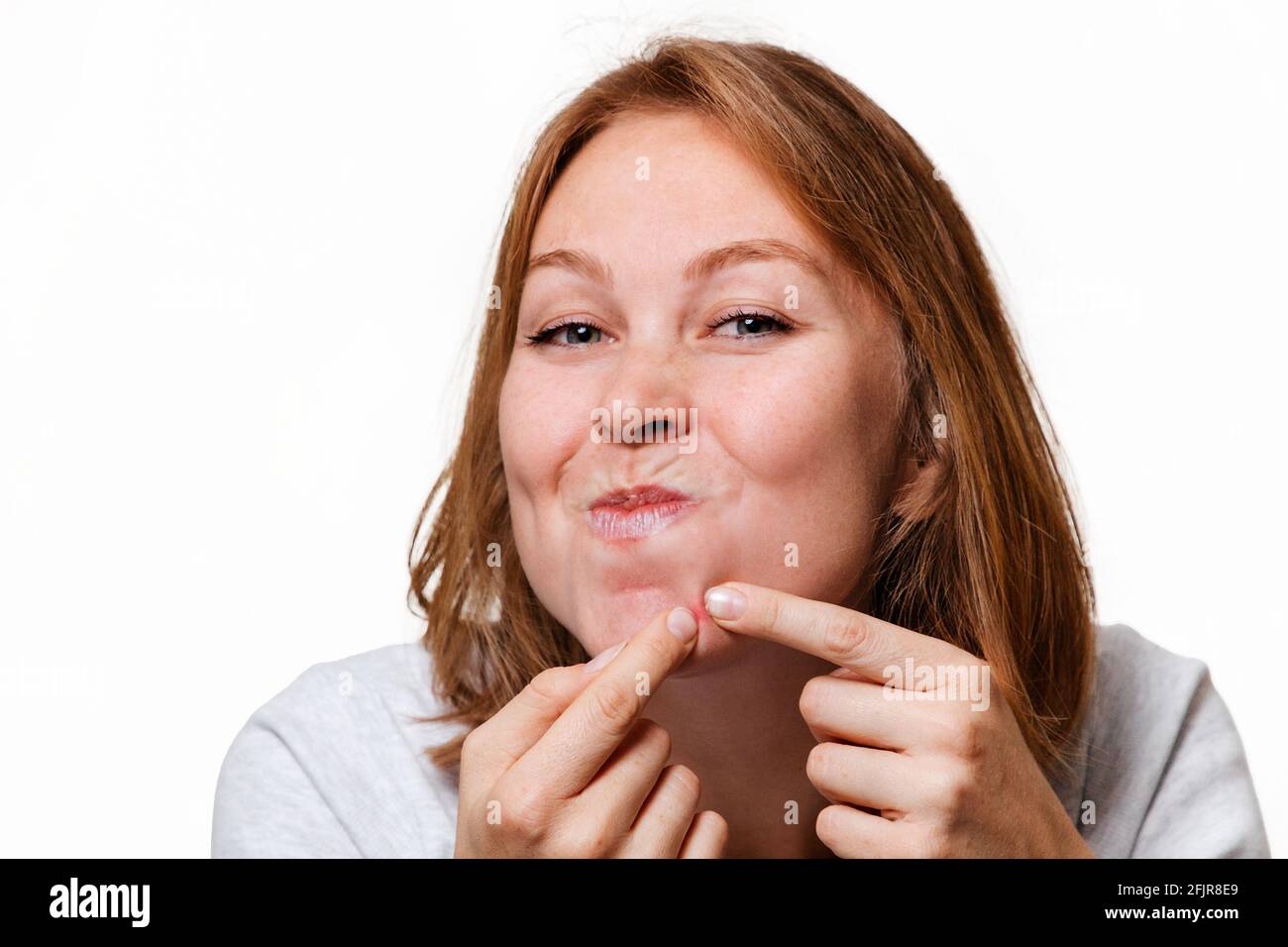 Portrait of a young girl squeezing out a pimple on her chin. White ...