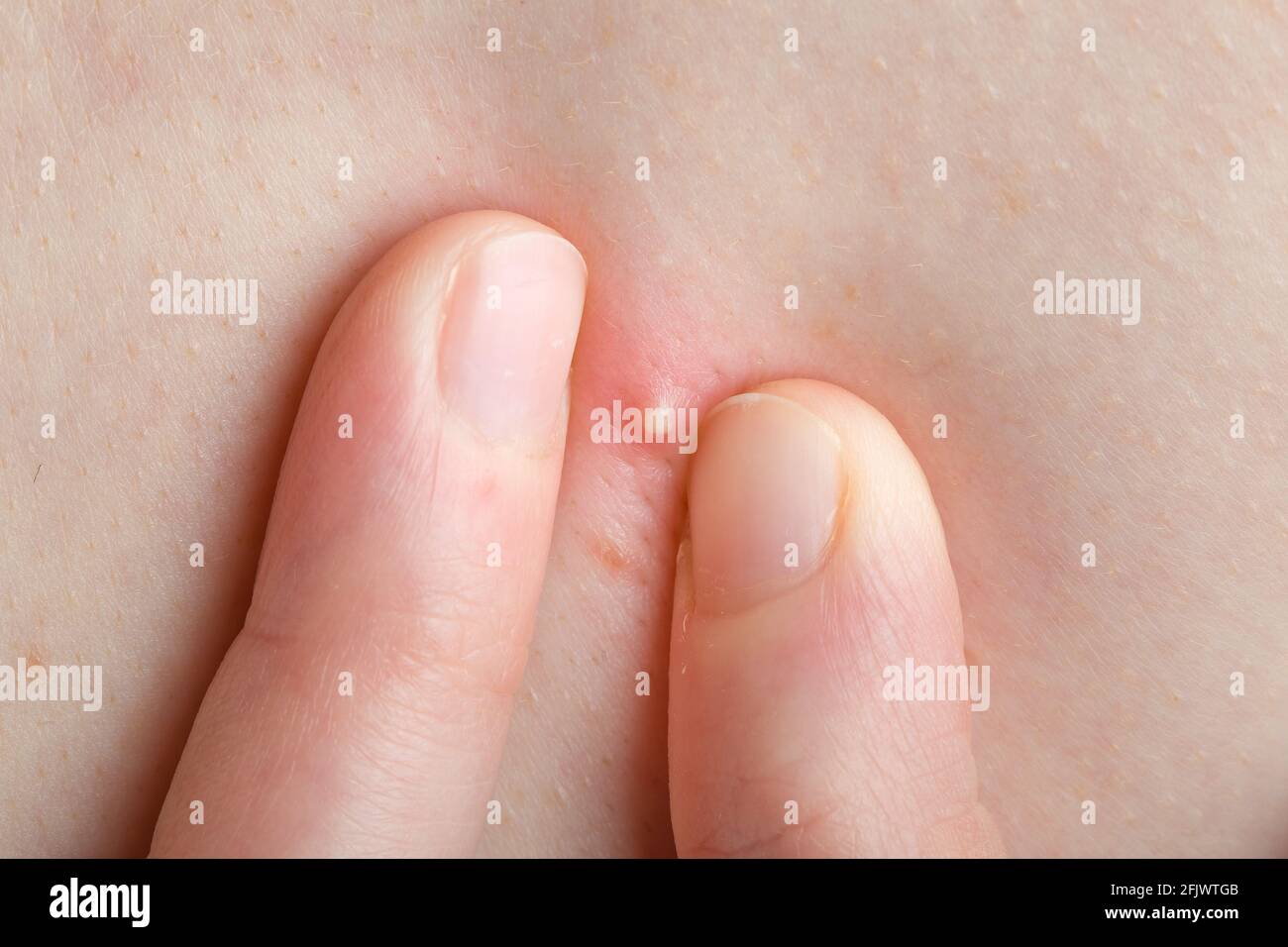 Vile Person High Resolution Stock Photography and Images - Alamy