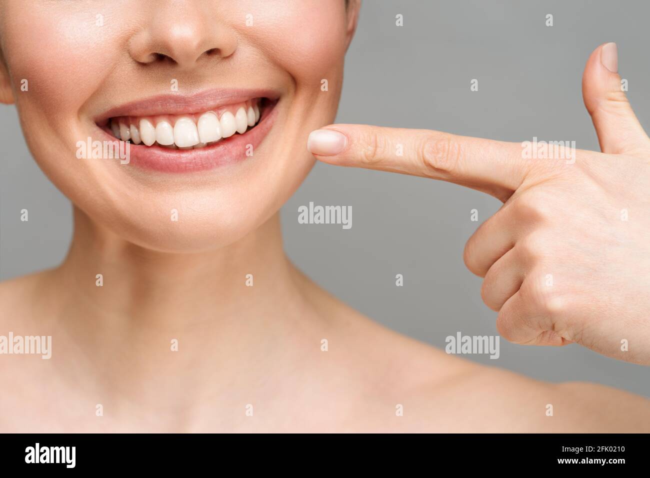 Perfect healthy teeth smile of a young woman. Teeth whitening. Dental ...