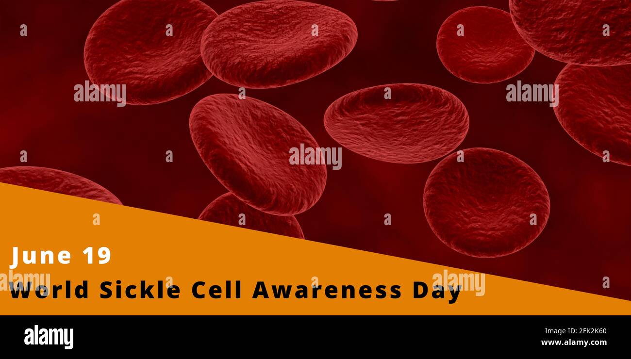 Sickle cell hi-res stock photography and images - Alamy