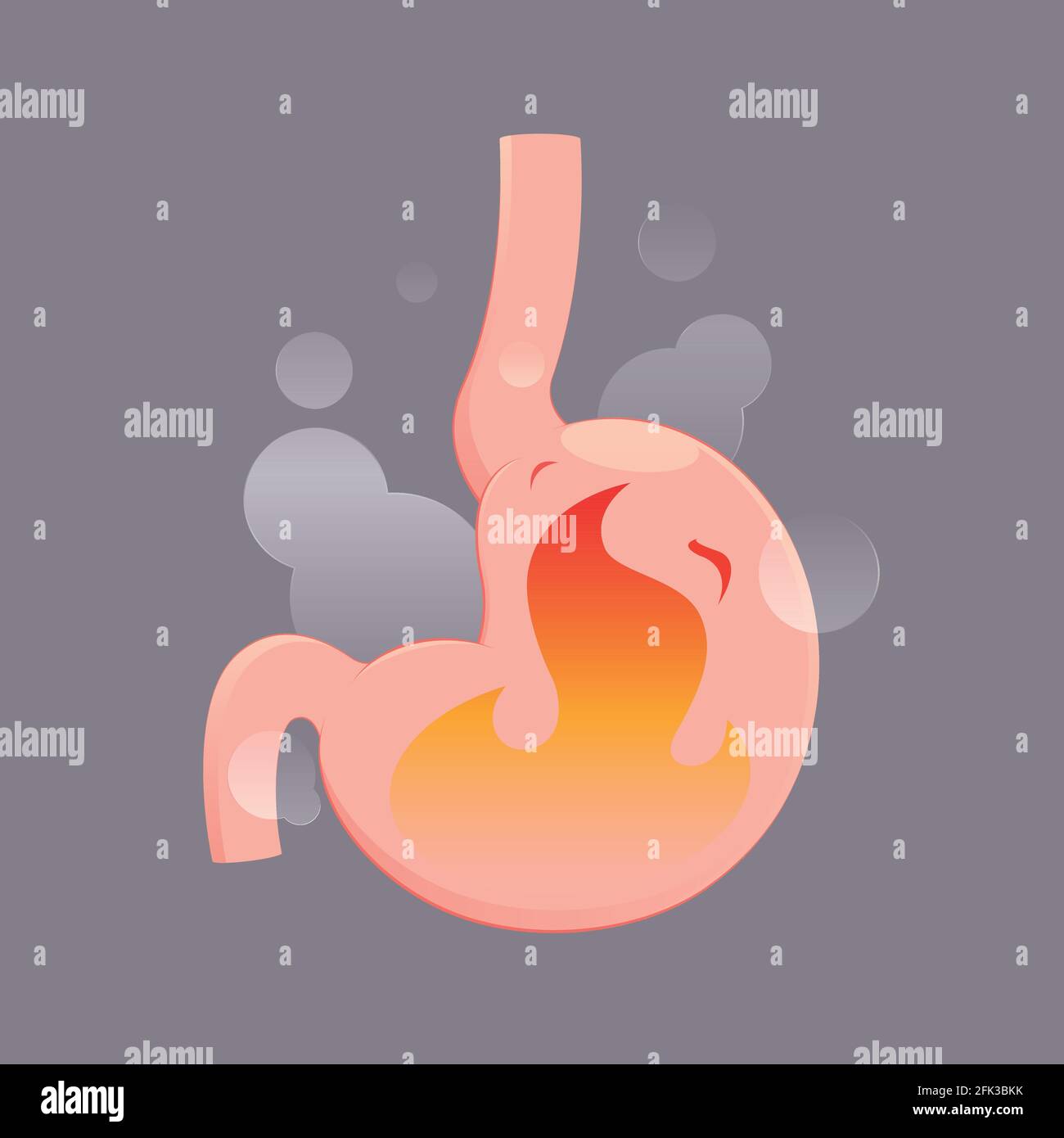 Illustration from acid reflux or heartburn, Cartoon vector, Concept ...