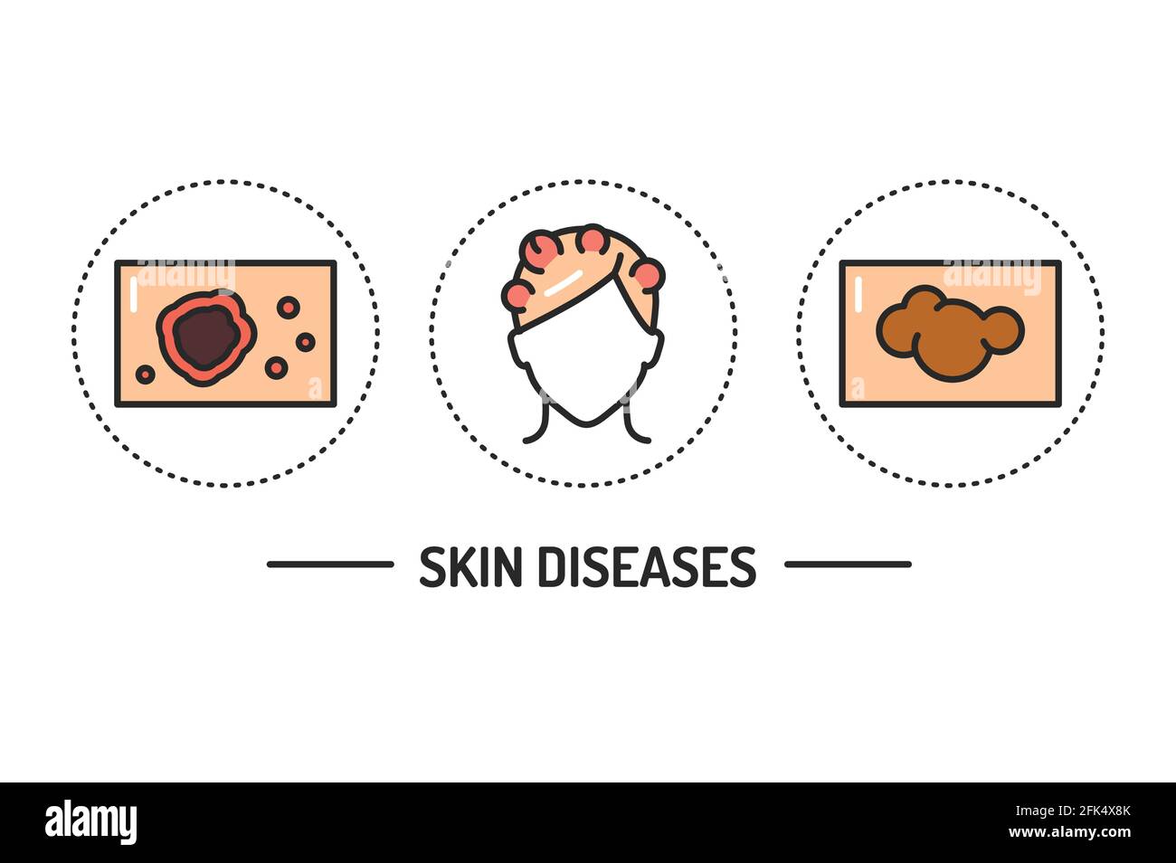 Skin diseases color line icons concept. Isolated vector element ...