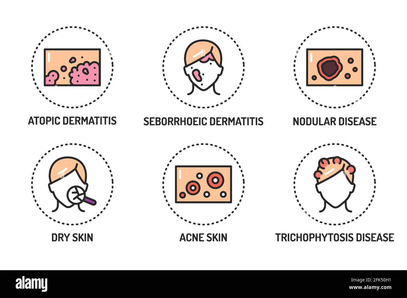 Malignant diseases Stock Vector Images - Alamy