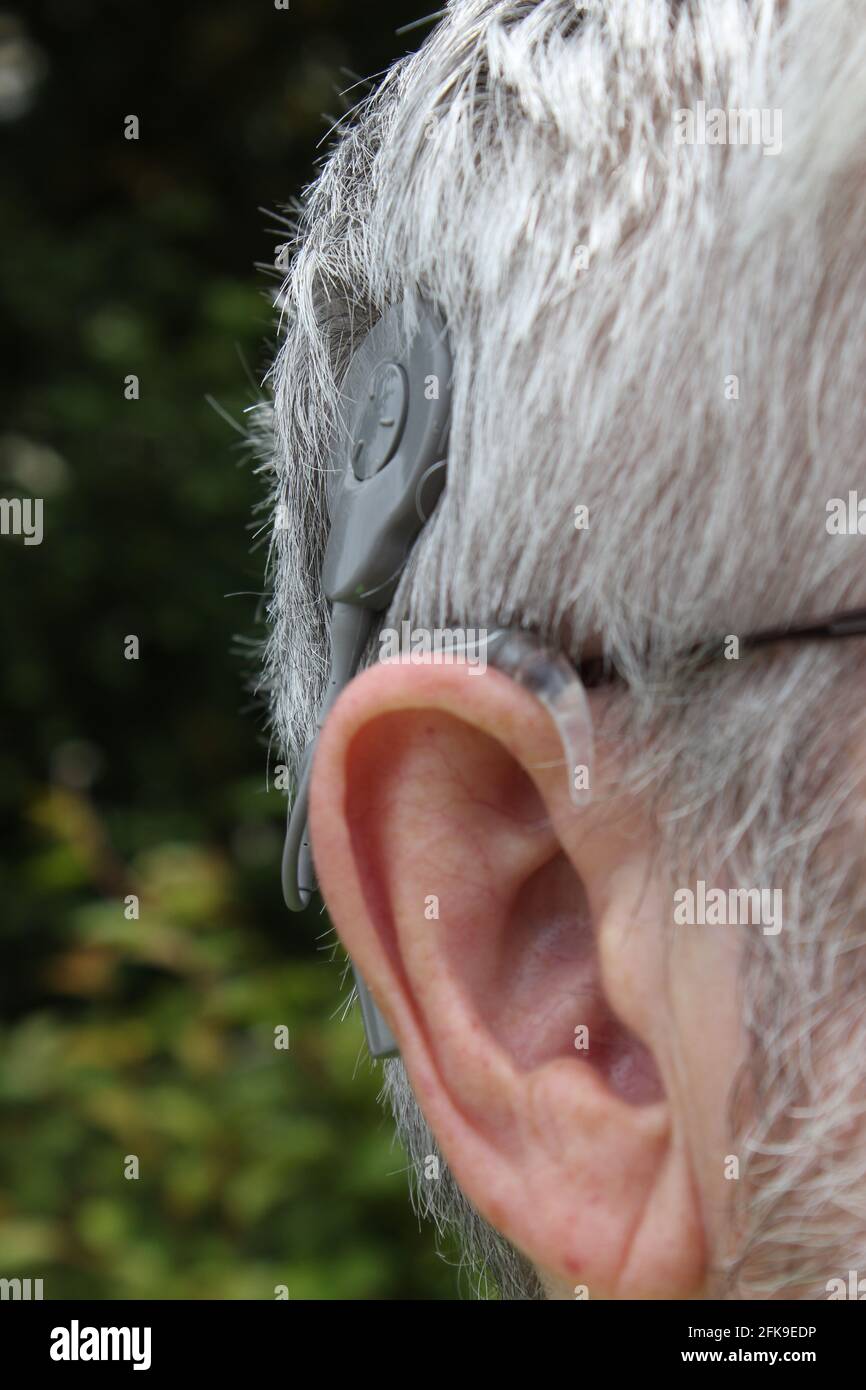 Cochlear Implant Hearing Device High Resolution Stock Photography and ...