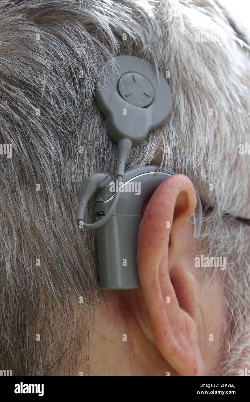 Medical device implants hi-res stock photography and images - Alamy