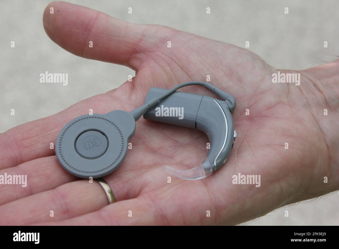 Child cochlear implant hi-res stock photography and images - Alamy