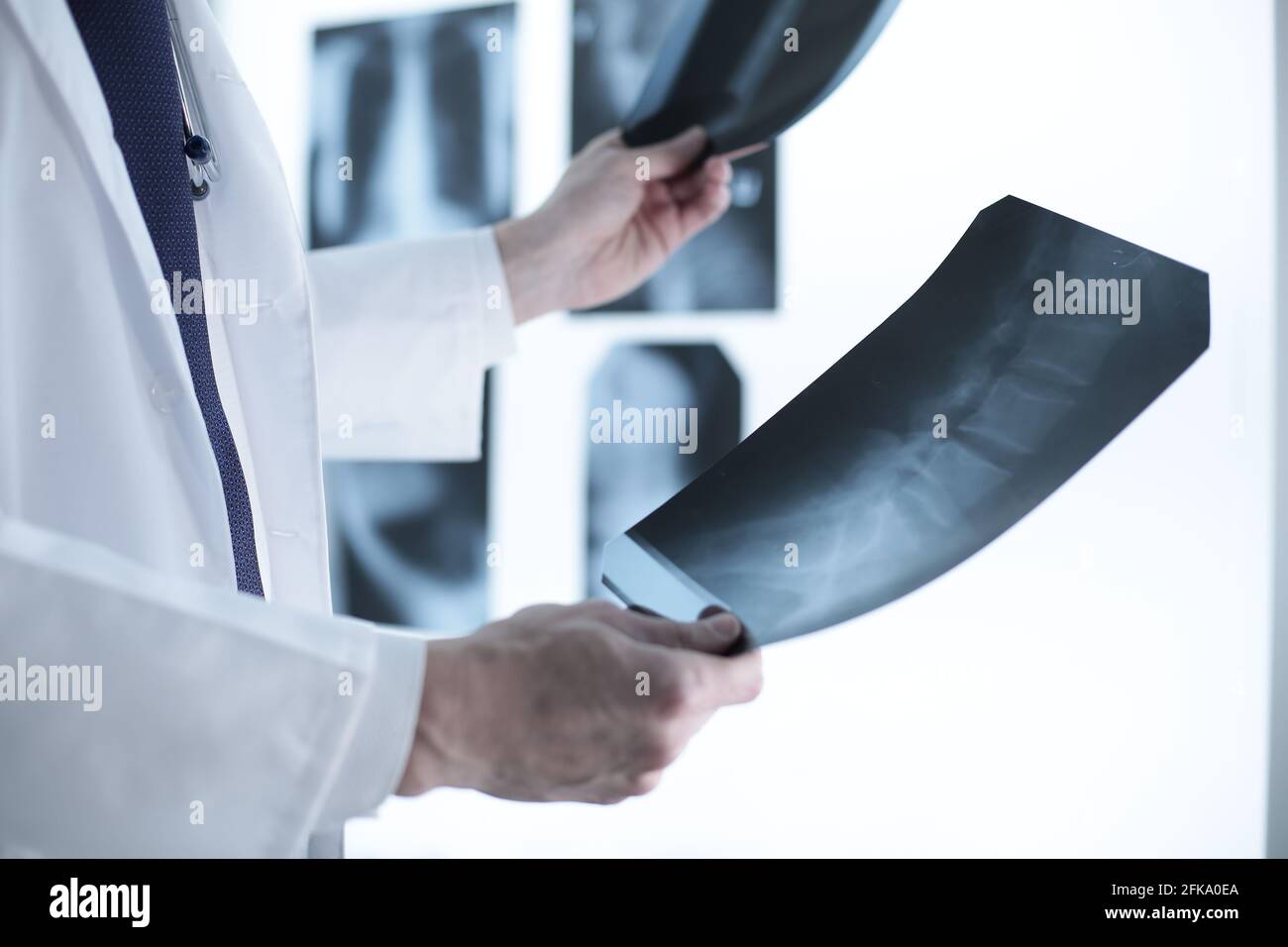 X ray films hi-res stock photography and images - Alamy