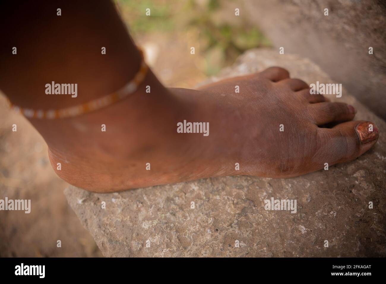 Zambian, African Dirty girl’s feet, poor girl life style, real need ...