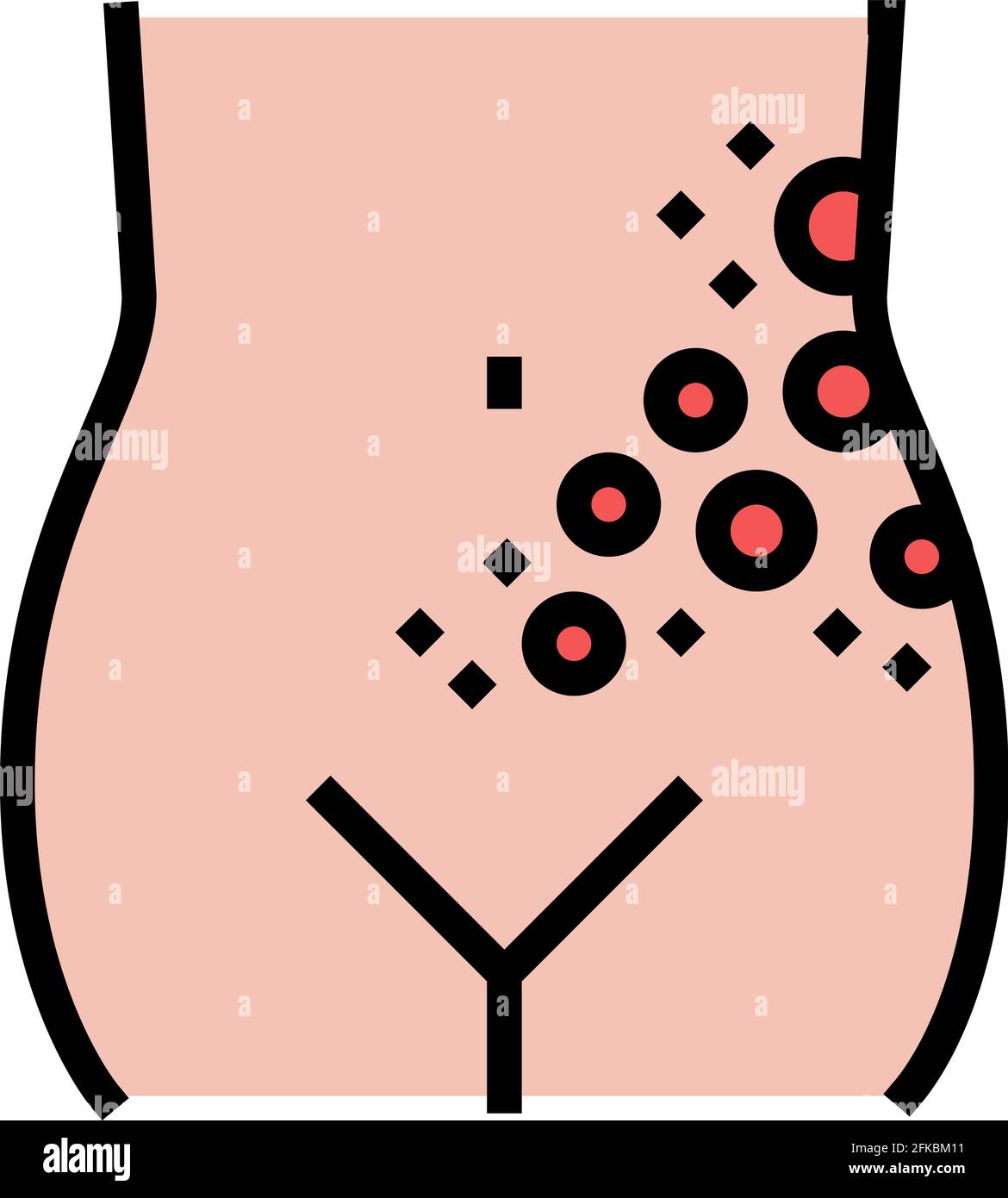 lichen shingles disease color icon vector illustration Stock Vector ...