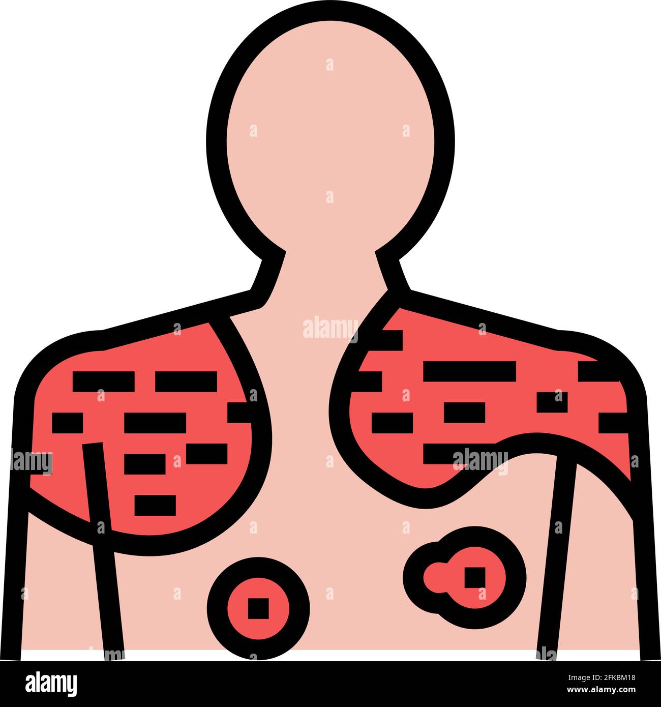 Psoriasis Disease Cut Out Stock Images & Pictures - Alamy