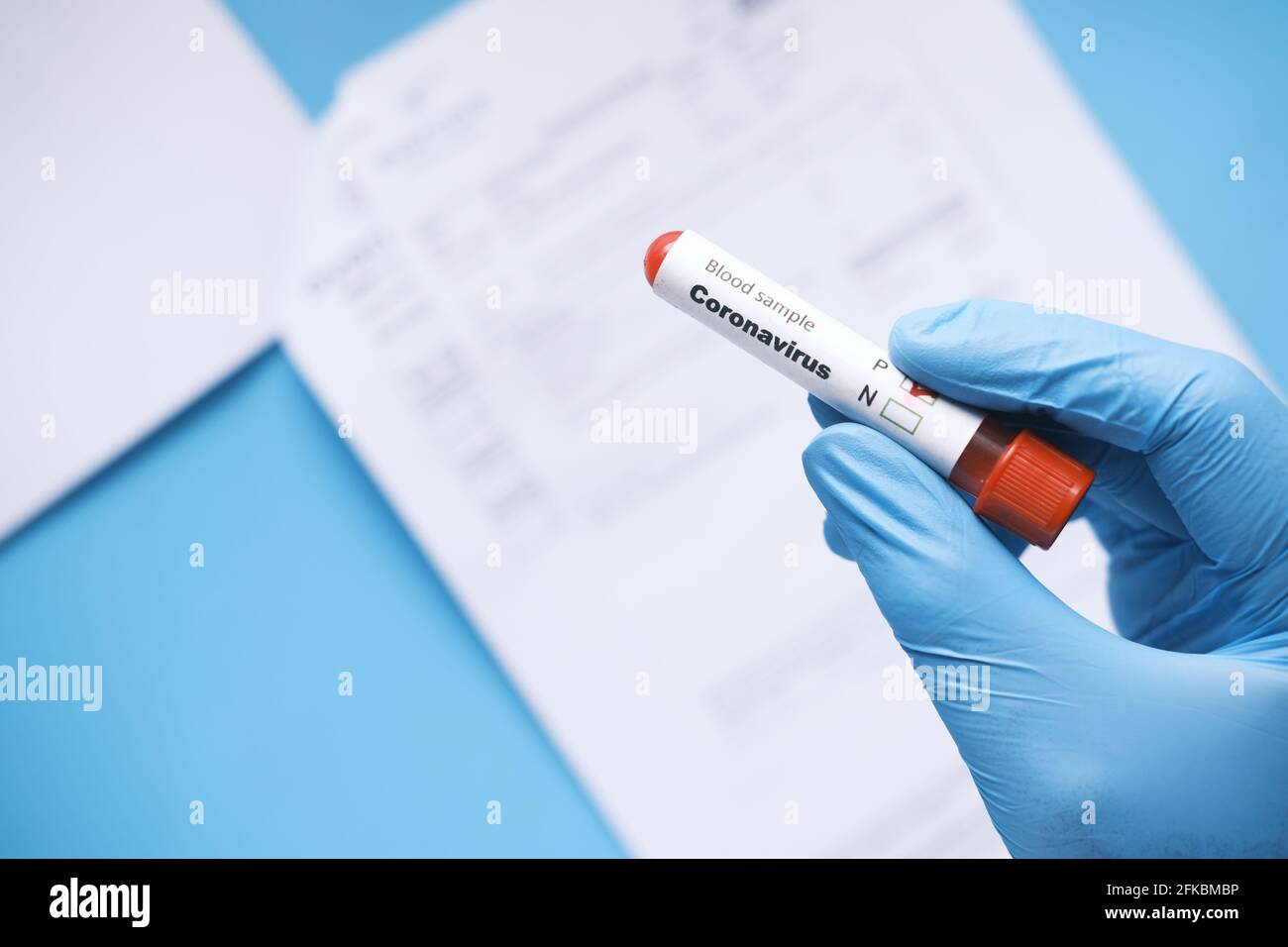 hand in blue medical gloves holding blood test tube and medical report ...