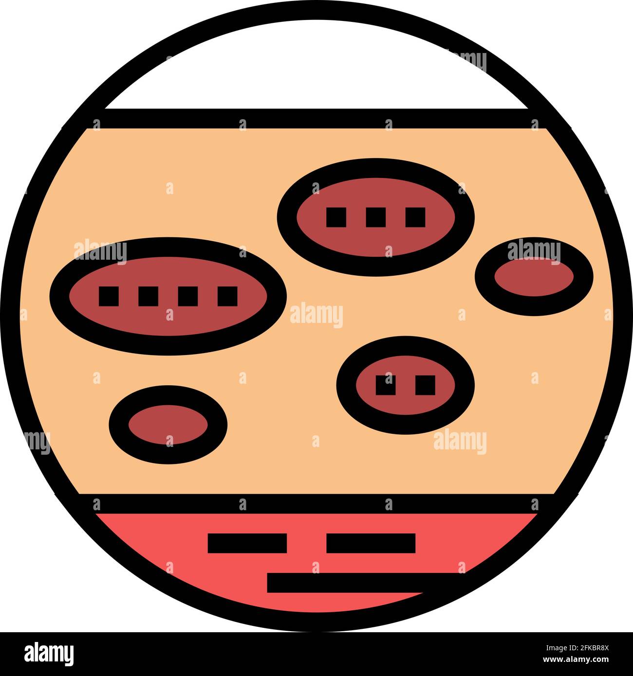 Nummular dermatitis hi-res stock photography and images - Alamy