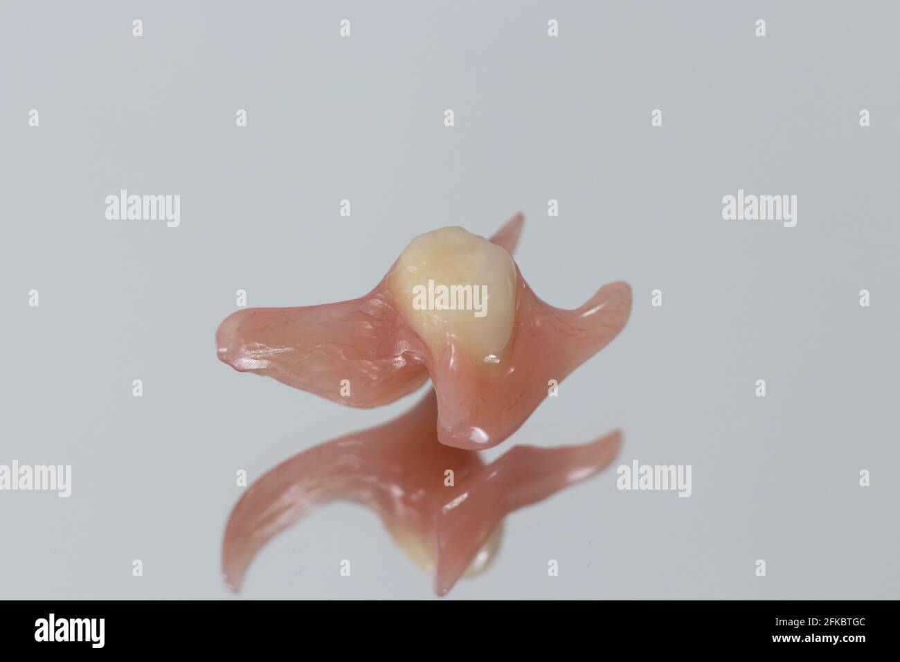 Artificial tooth prosthesis in on a blue background. Single removable ...