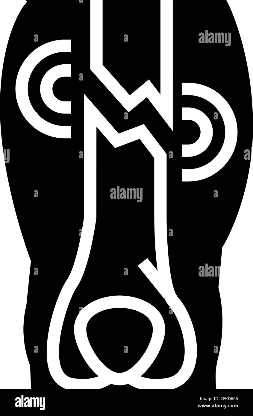 closed limb fracture disease glyph icon vector illustration Stock ...