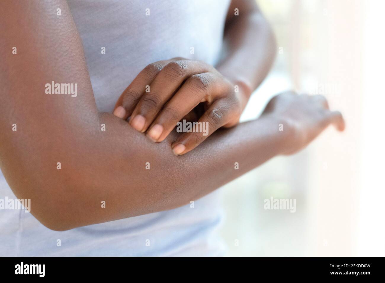 Woman scratching her arm Stock Photo - Alamy