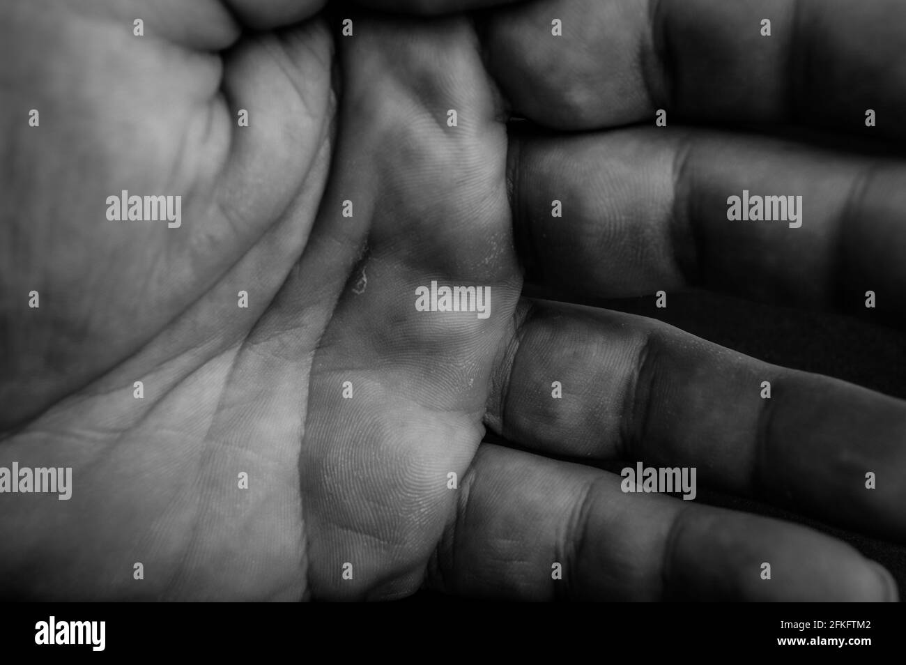 Withered Hand High Resolution Stock Photography and Images - Alamy
