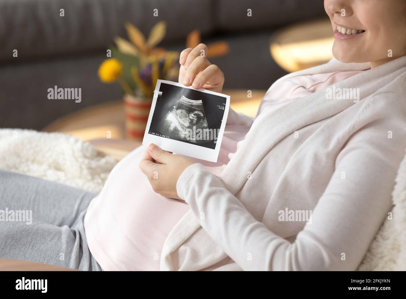 Baby ultrasound hi-res stock photography and images - Alamy