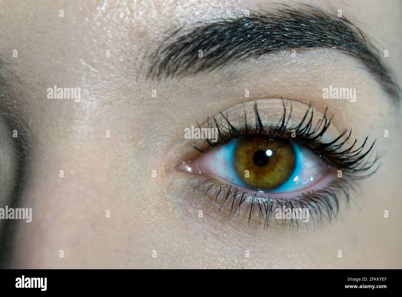Contact lens placement in the eye Stock Photo - Alamy