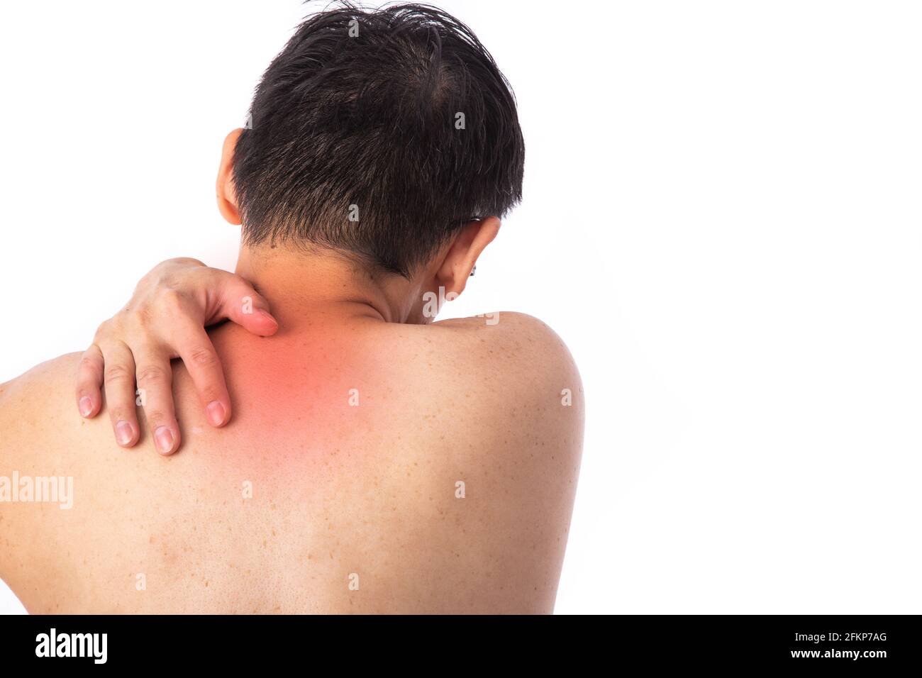 Shoulder sprain hi-res stock photography and images - Alamy